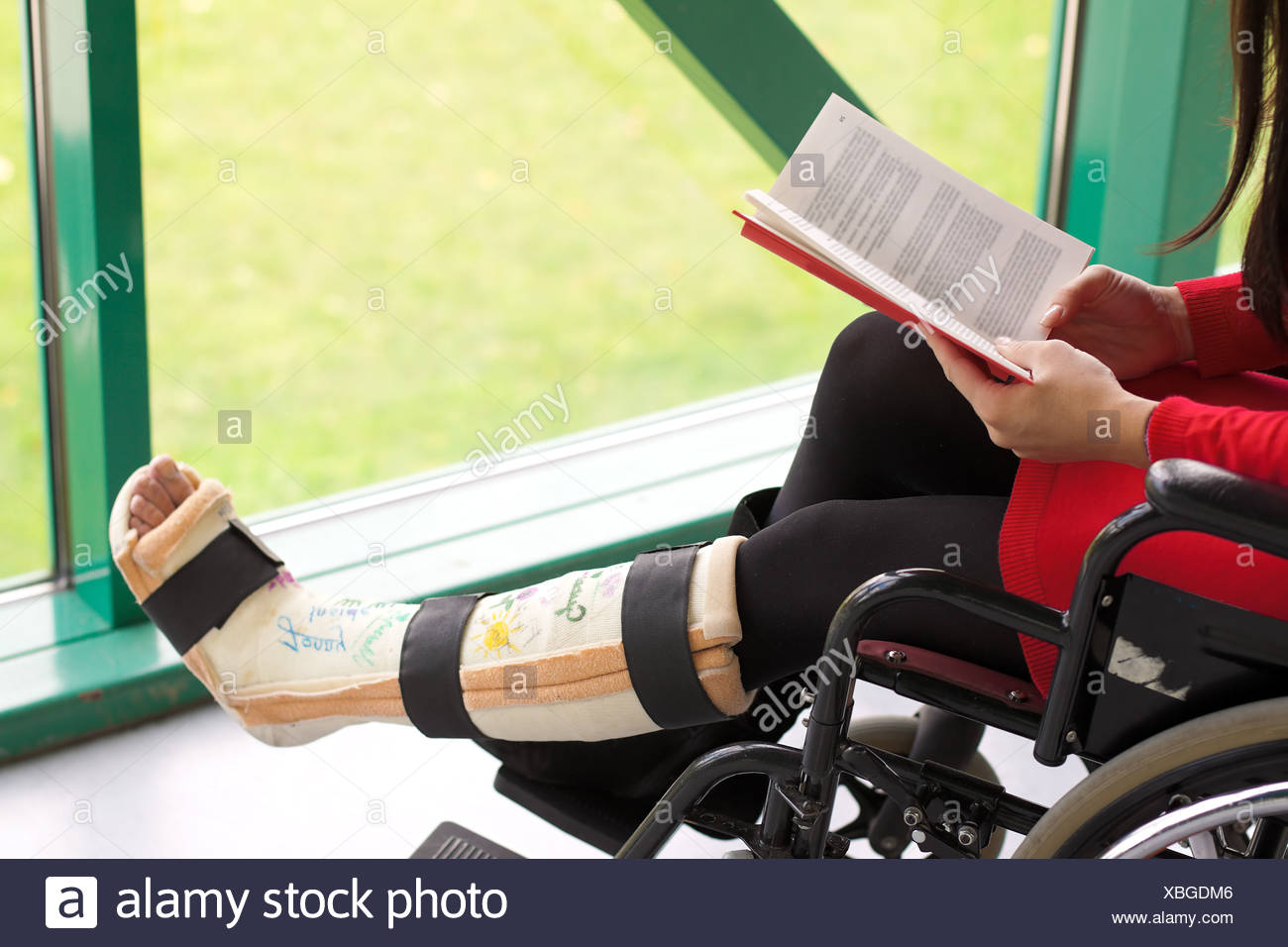 Woman Leg Cast High Resolution Stock Photography and Images - Alamy