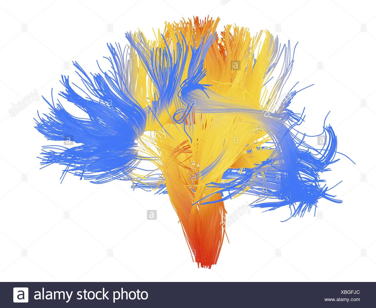 Diffusion Mri Brain High Resolution Stock Photography and Images - Alamy