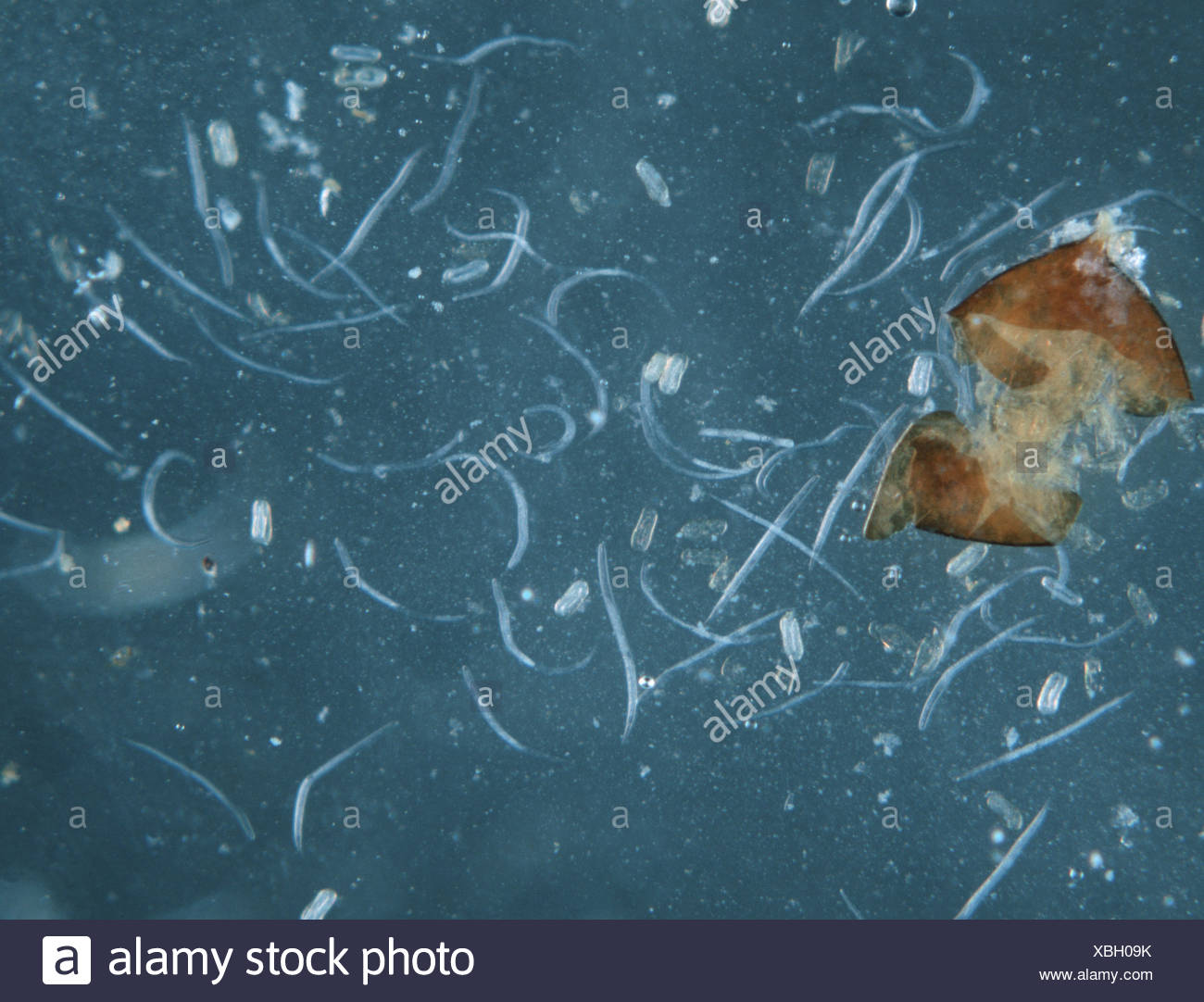 Free Living Nematode High Resolution Stock Photography and Images - Alamy