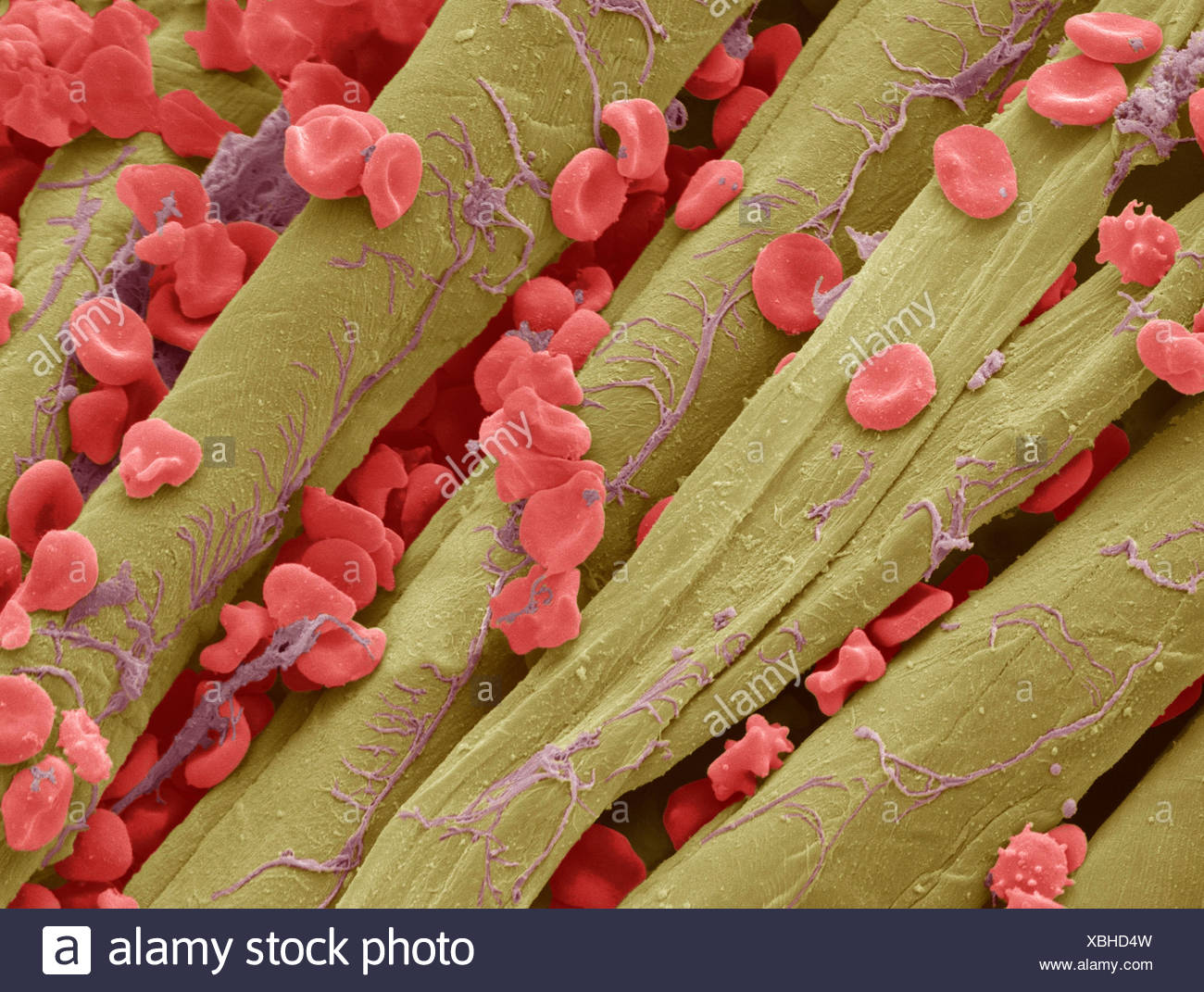 Scanning Electron Micrograph Fibrin High Resolution Stock Photography ...