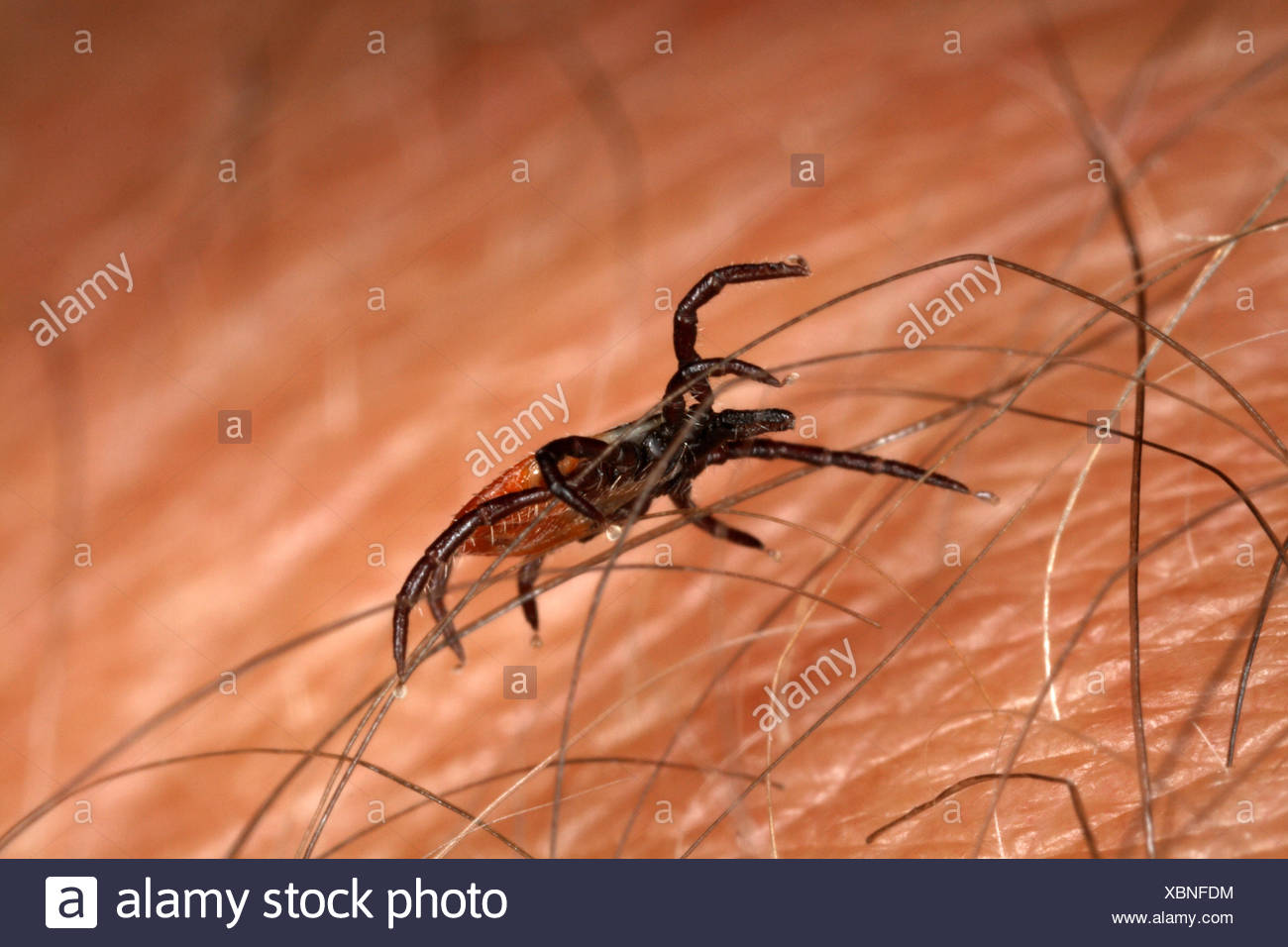 Sheep Ticks Stock Photos & Sheep Ticks Stock Images - Alamy
