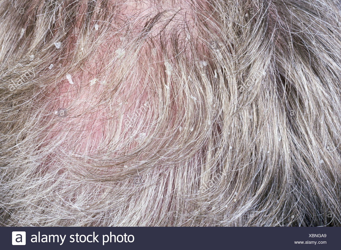 Bald Shiny Head High Resolution Stock Photography and Images - Alamy