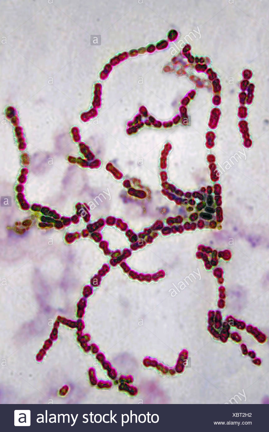 Streptococcal High Resolution Stock Photography and Images - Alamy