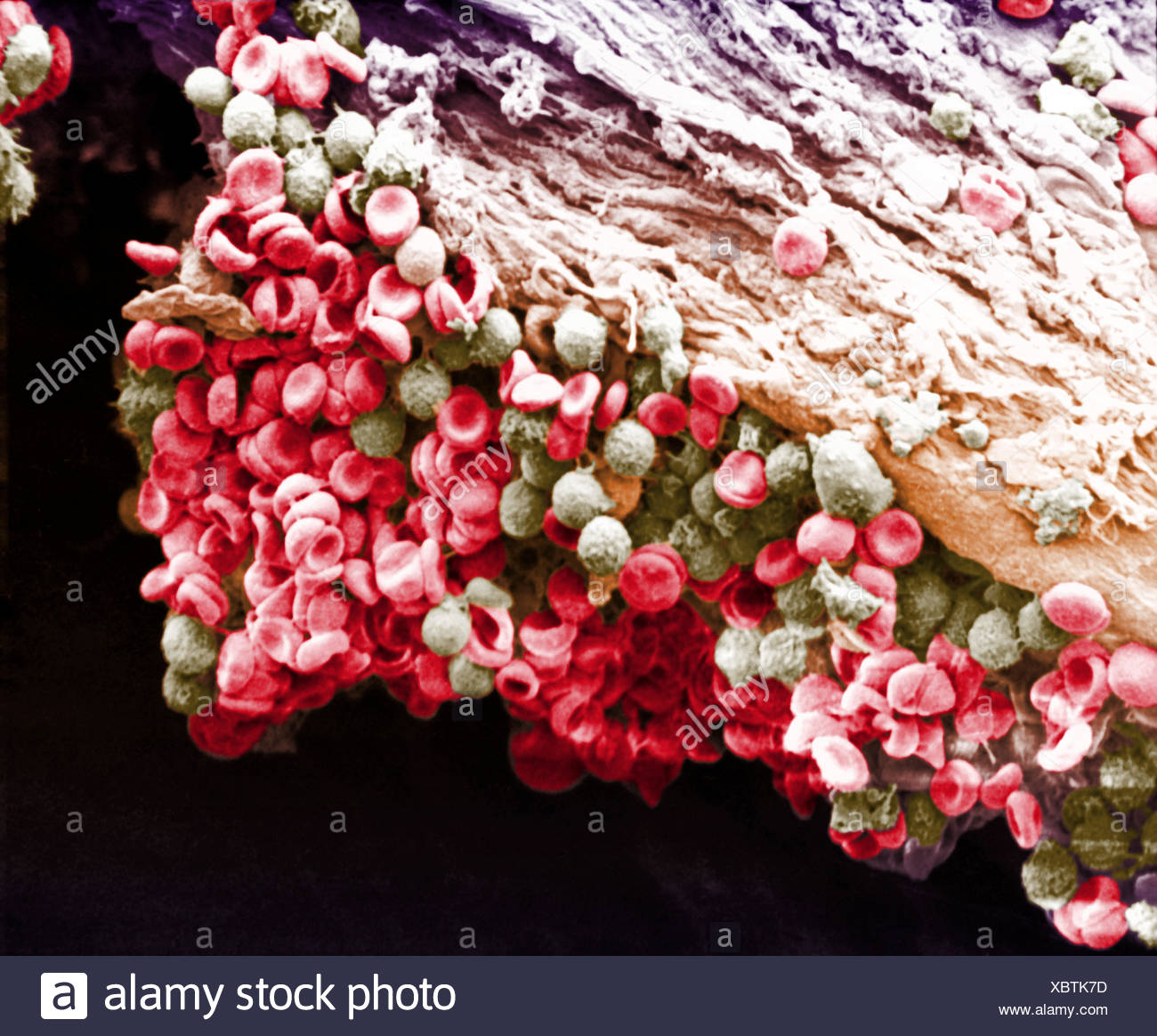 Sem Blood Red White Cells High Resolution Stock Photography and Images ...