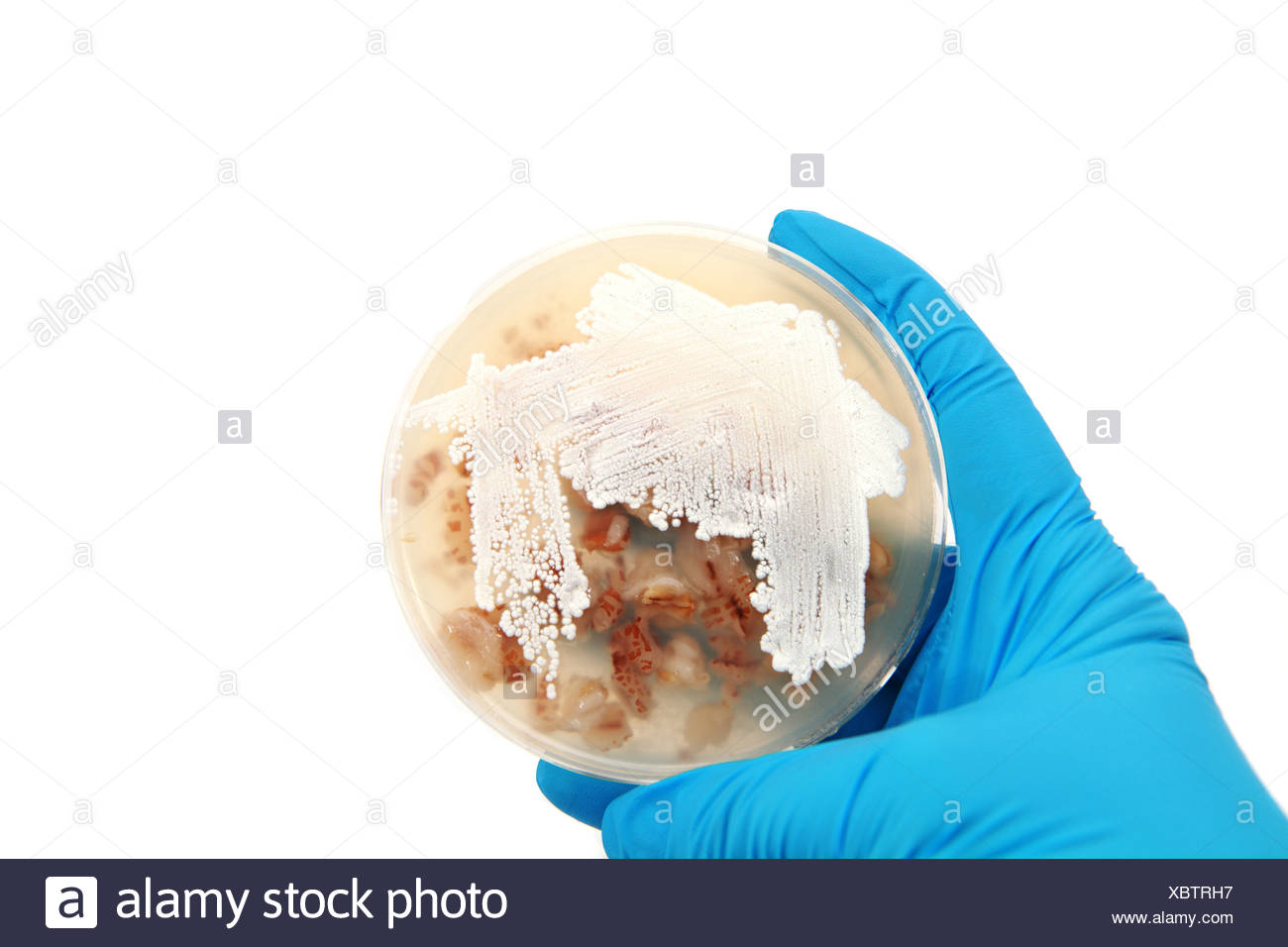 Streptomyces High Resolution Stock Photography and Images - Alamy