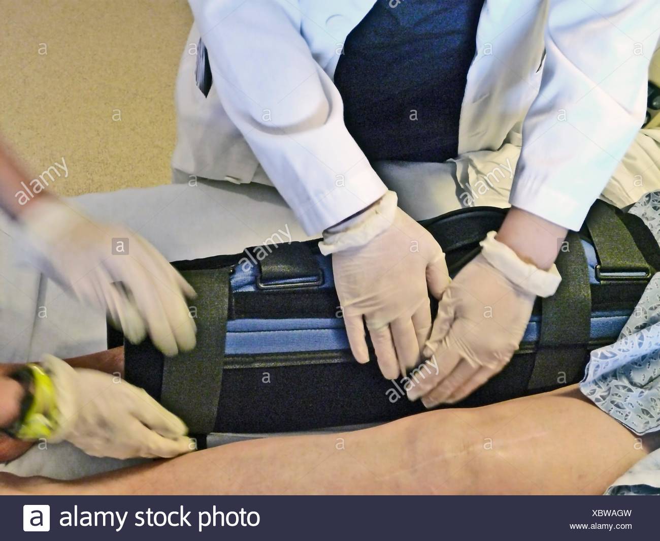 Dvt Leg Stock Photos & Dvt Leg Stock Images - Alamy