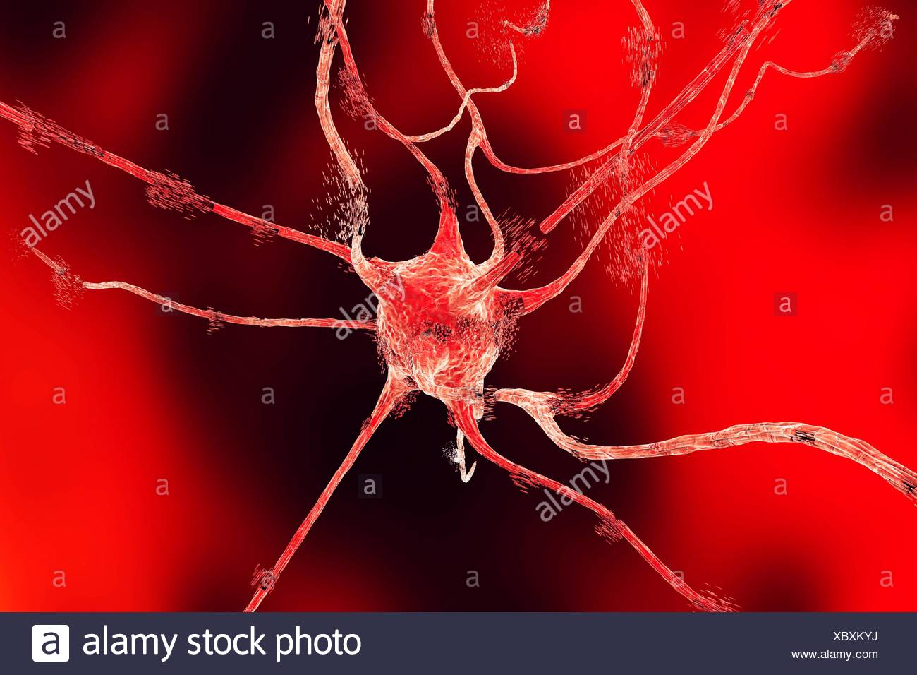 Disorders Of The Nervous System Stock Photos & Disorders Of The Nervous ...