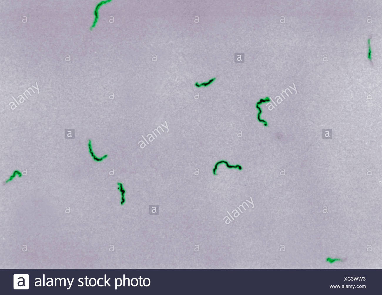 Treponema Pallidum High Resolution Stock Photography and Images - Alamy