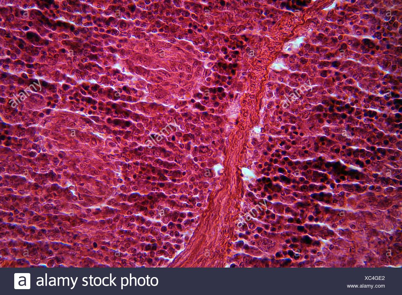 Healthy Pancreas High Resolution Stock Photography and Images - Alamy