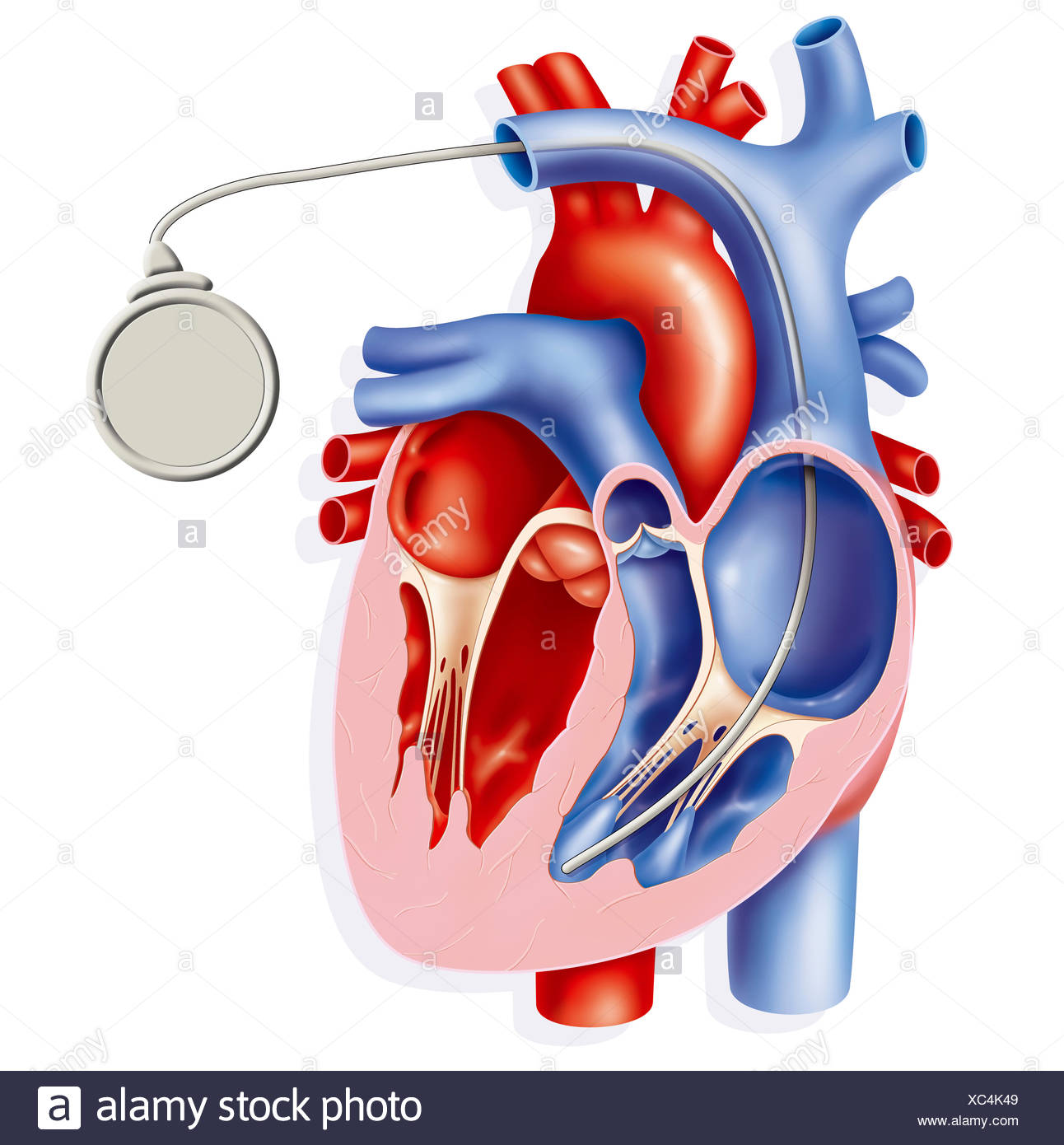 Atrioventricular Stock Photos & Atrioventricular Stock Images - Alamy