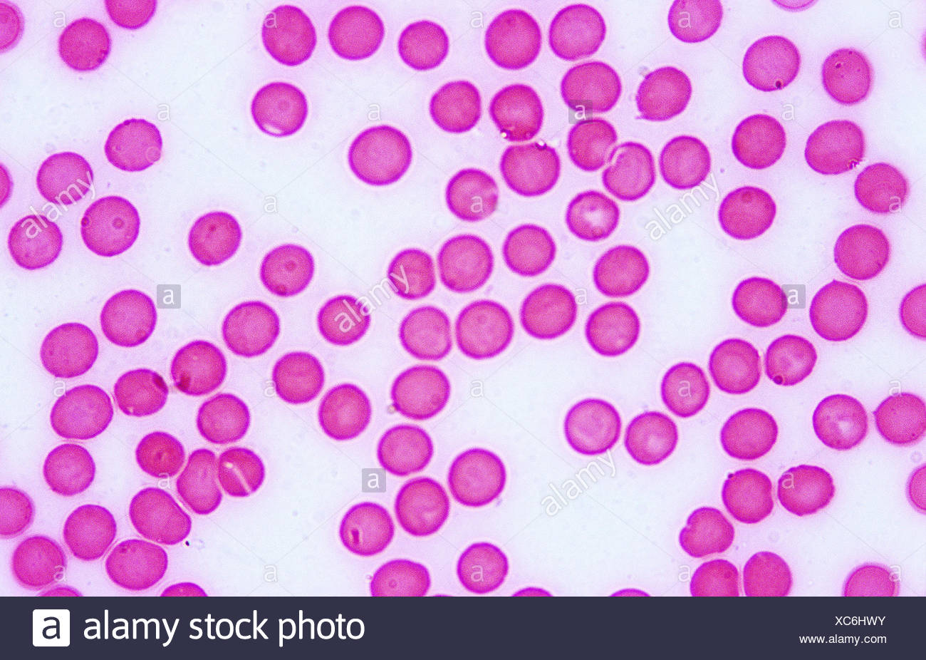 Human Blood Smear High Resolution Stock Photography and Images - Alamy