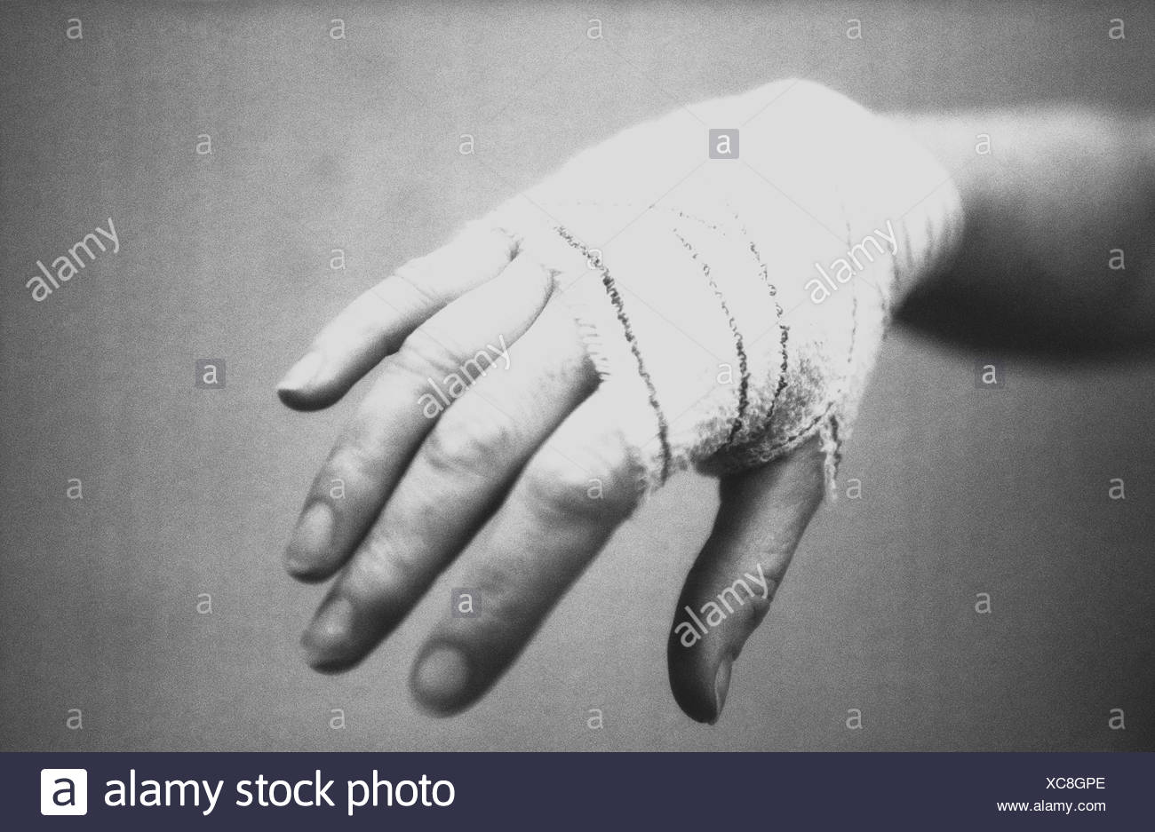 Bandaged Hand Stock Photos & Bandaged Hand Stock Images - Alamy