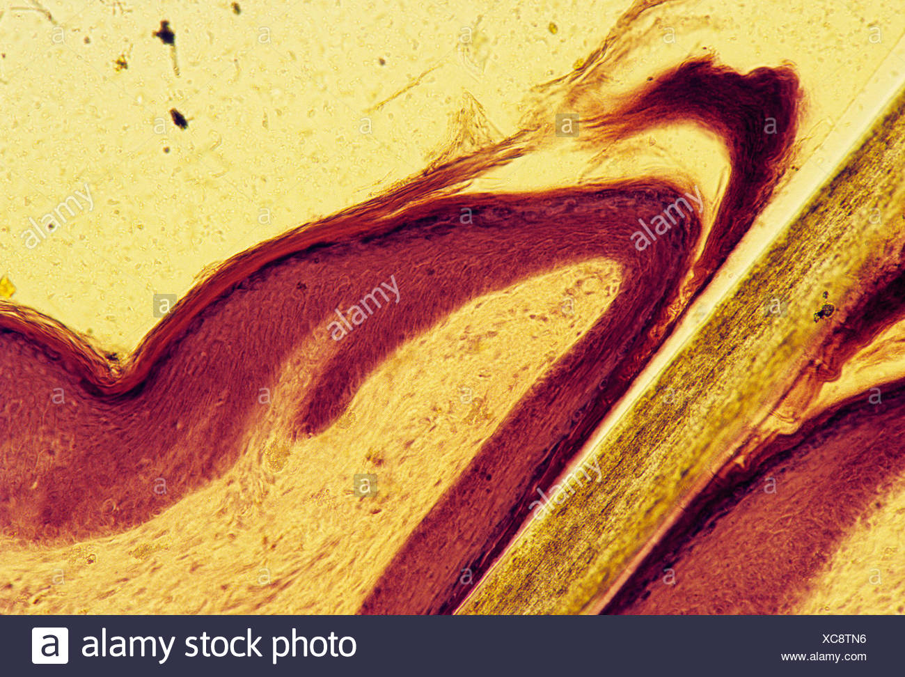 Hair Follicle Microscope High Resolution Stock Photography and Images ...
