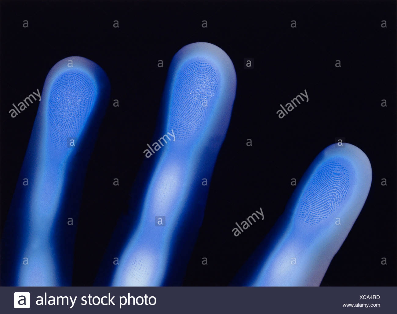 Whorl Fingerprint High Resolution Stock Photography and Images - Alamy
