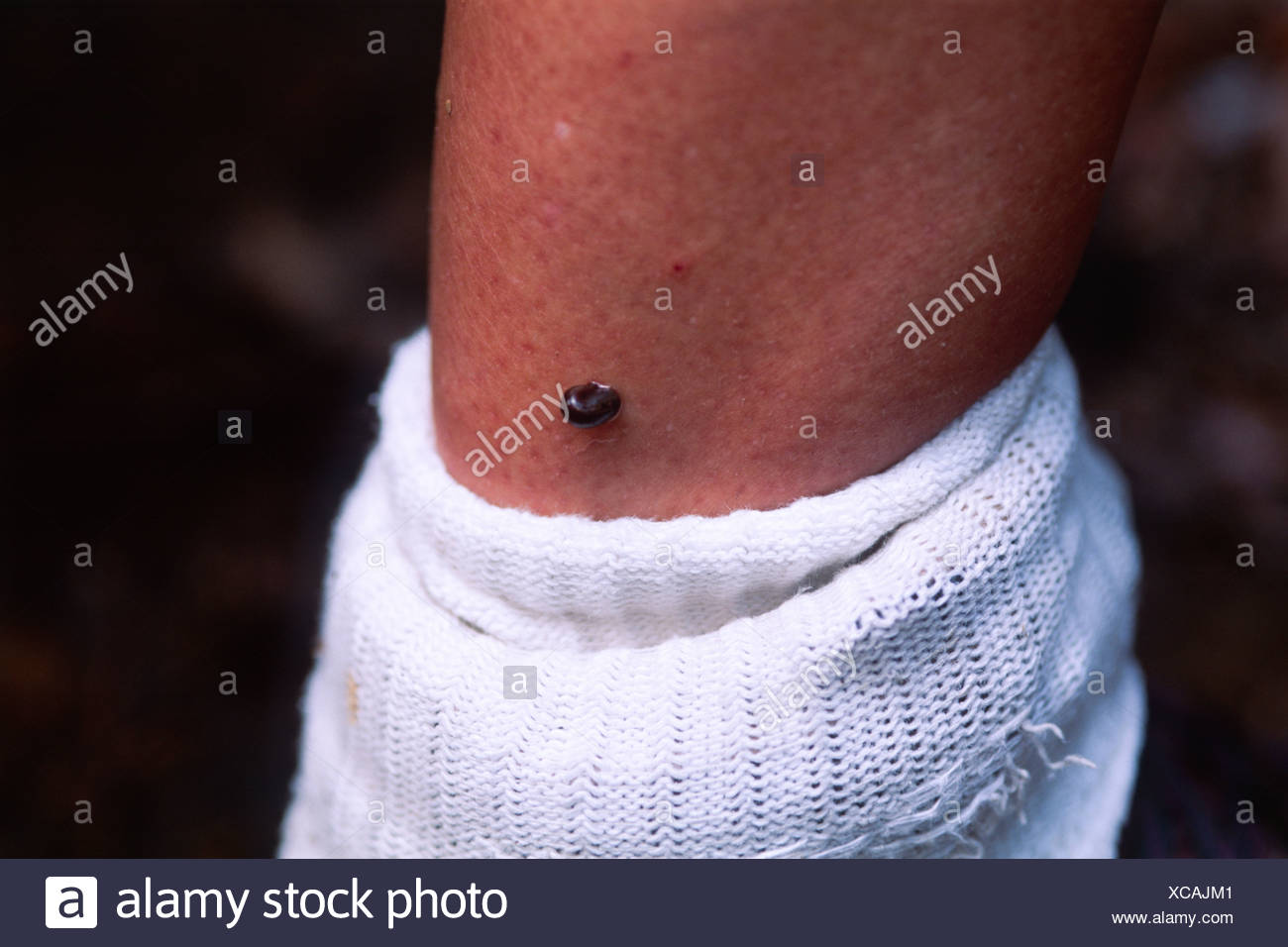 Leech High Resolution Stock Photography and Images - Alamy