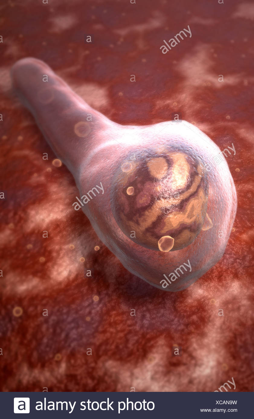 Clostridium Tetani High Resolution Stock Photography and Images - Alamy