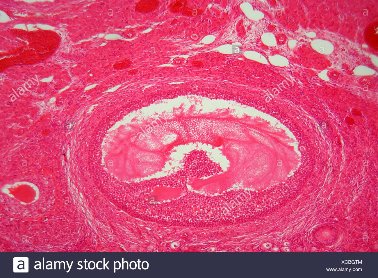 Ovary High Resolution Stock Photography and Images - Alamy