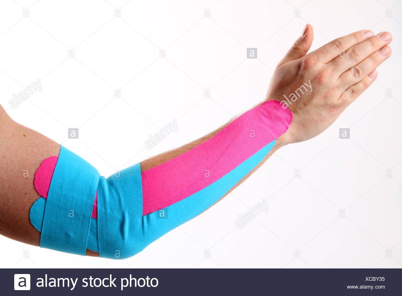 Tennis Elbow Stock Photos & Tennis Elbow Stock Images - Alamy