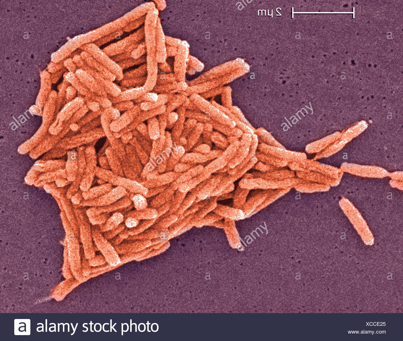 Legionella Bacteria Stock Photos & Legionella Bacteria Stock Images - Alamy