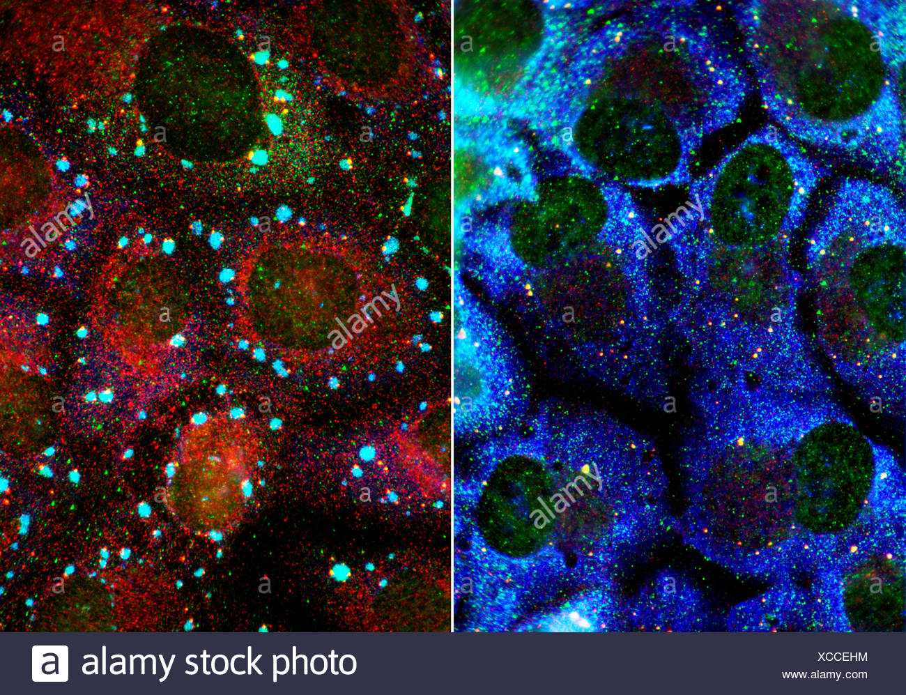 Normal Cell To Cancer High Resolution Stock Photography and Images - Alamy