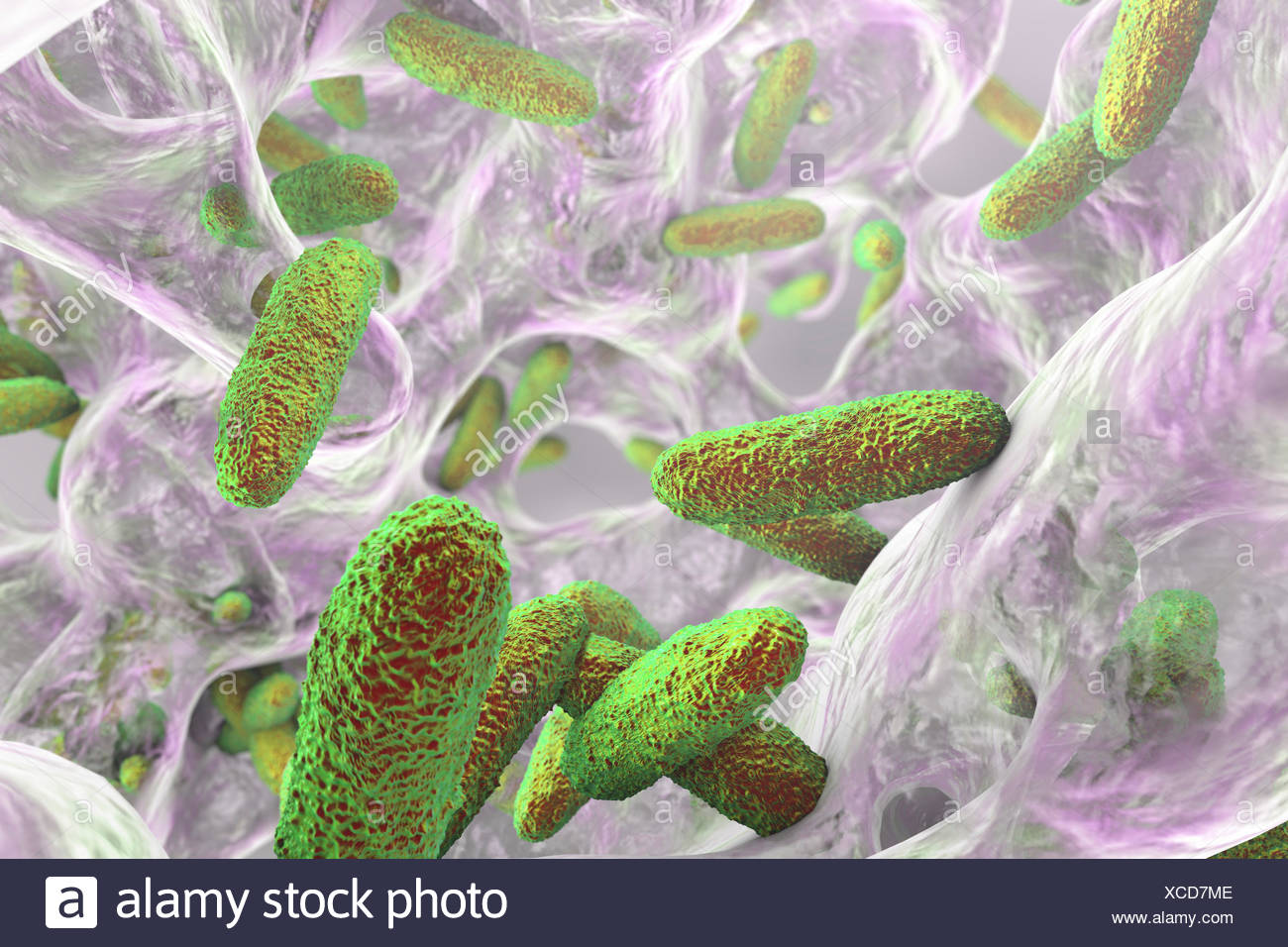 Klebsiella Pneumonia Stock Photos & Klebsiella Pneumonia Stock Images ...