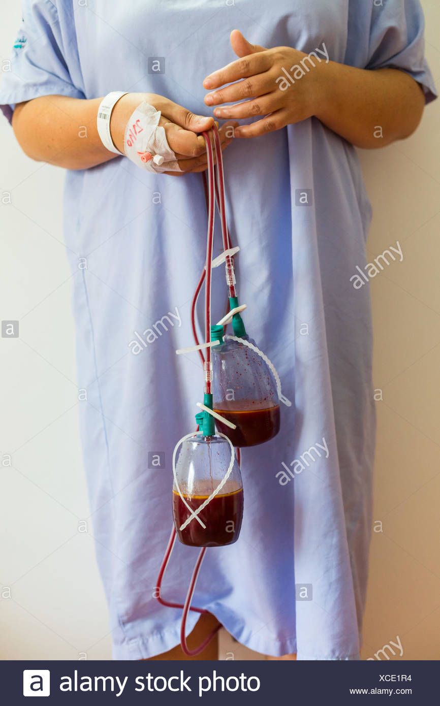 After Surgery Stock Photos & After Surgery Stock Images - Alamy