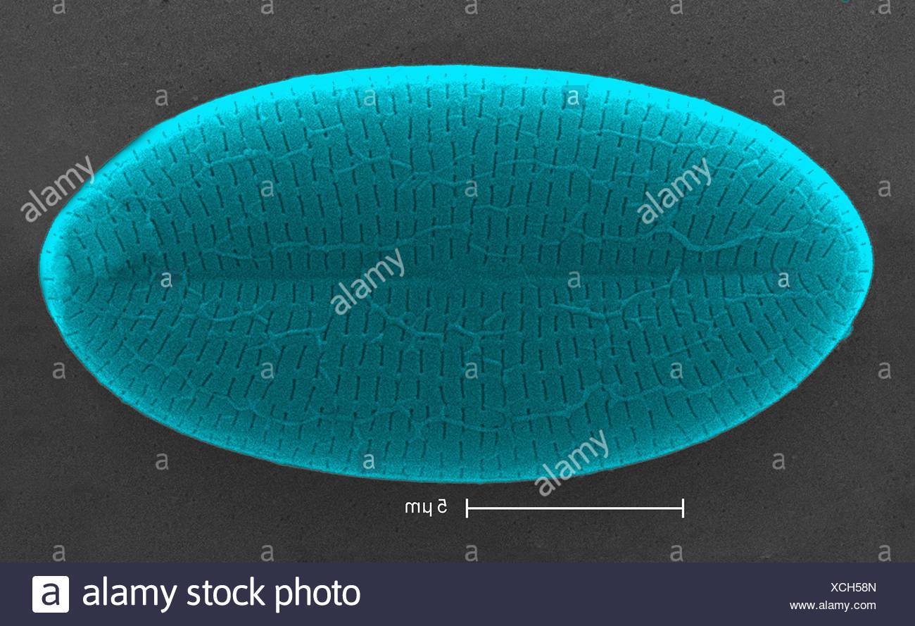 Blue Green Algae Micrograph High Resolution Stock Photography and ...