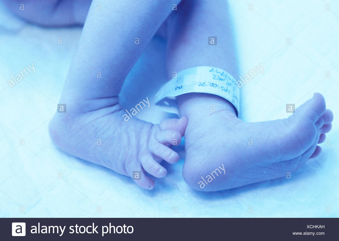 Phototherapy Unit High Resolution Stock Photography and Images - Alamy