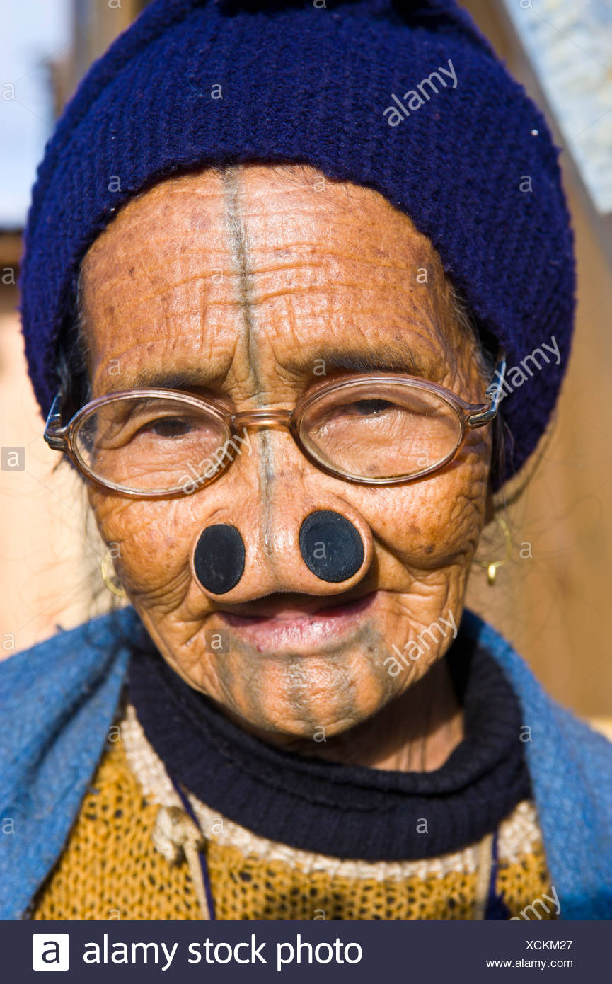 Woman No Nose High Resolution Stock Photography and Images - Alamy