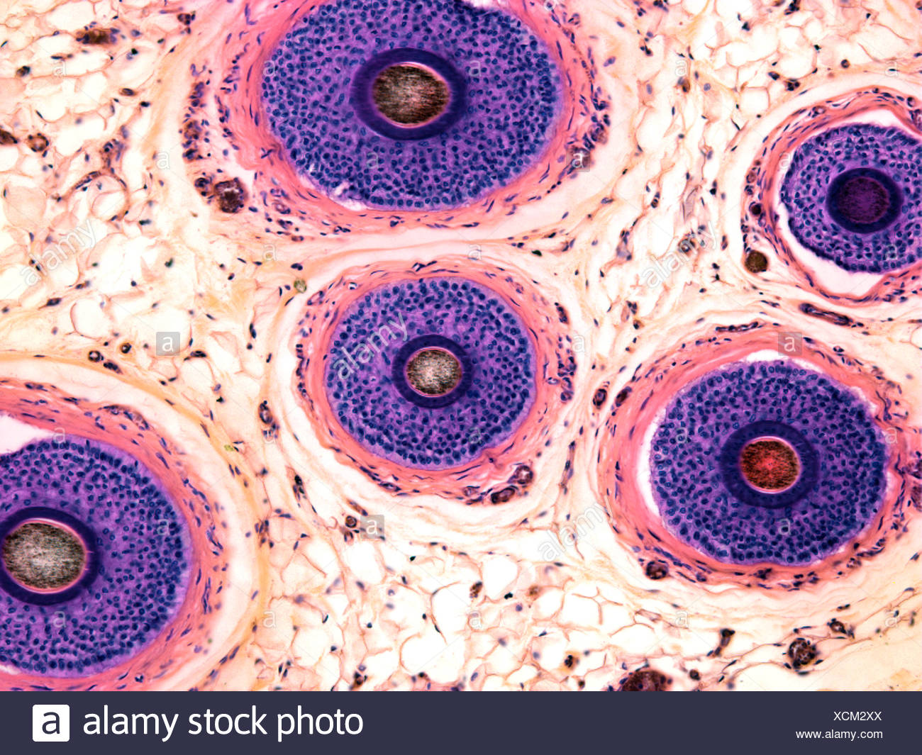 Follicle Micrograph Stock Photos & Follicle Micrograph Stock Images - Alamy