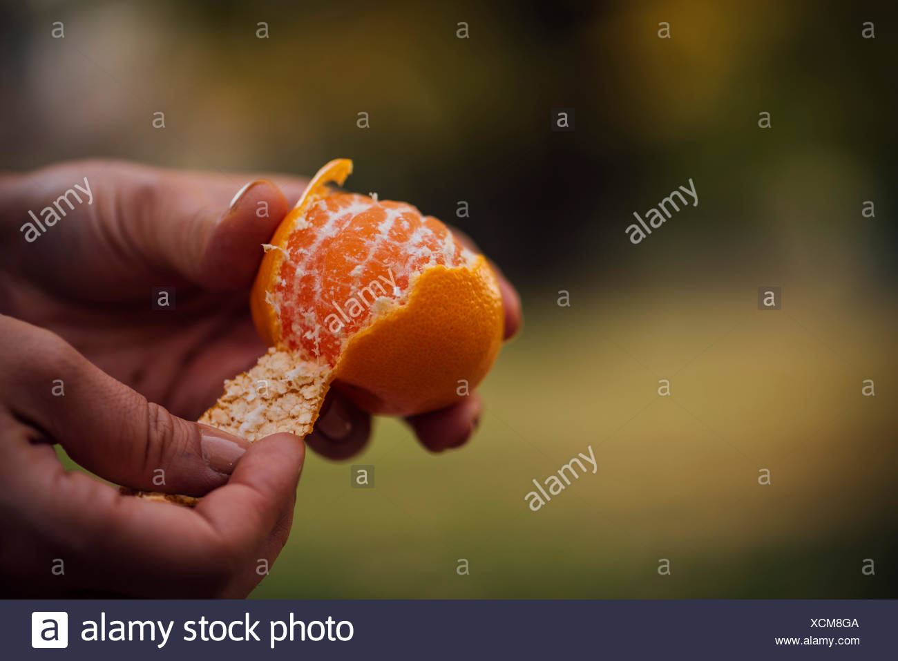 Peeling Skin High Resolution Stock Photography and Images - Alamy