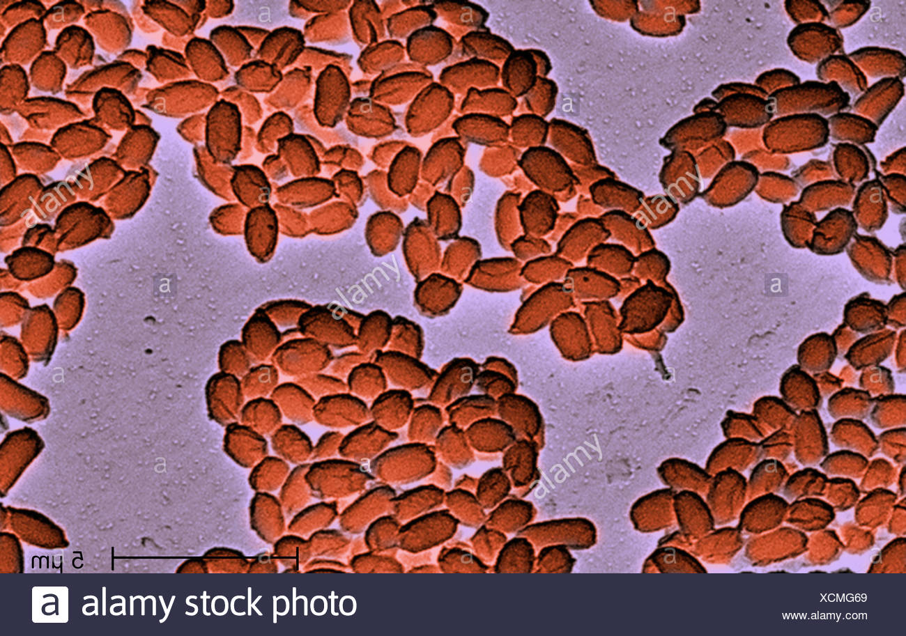 Electron Micrograph Bacillus Anthracis Bacteria Stock Photos & Electron ...