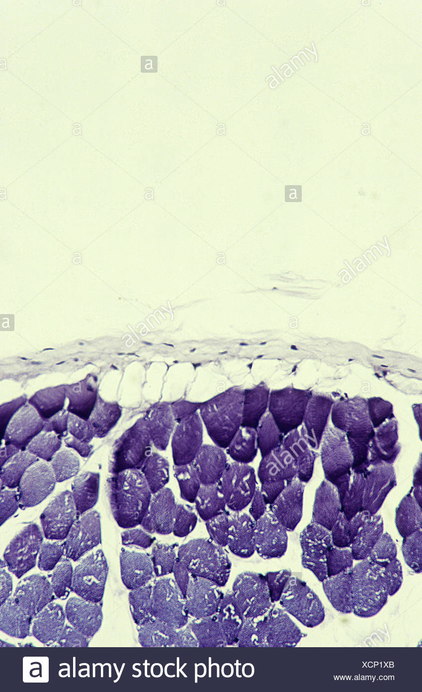 Striated Muscle Skeletal High Resolution Stock Photography and Images ...