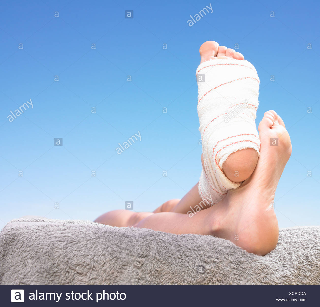 Plaster Foot High Resolution Stock Photography and Images - Alamy