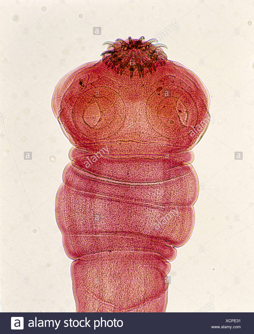 Taenia Solium High Resolution Stock Photography and Images - Alamy