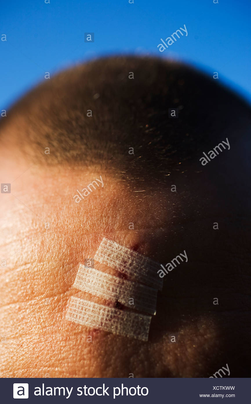 Forehead Band Aid High Resolution Stock Photography and Images - Alamy