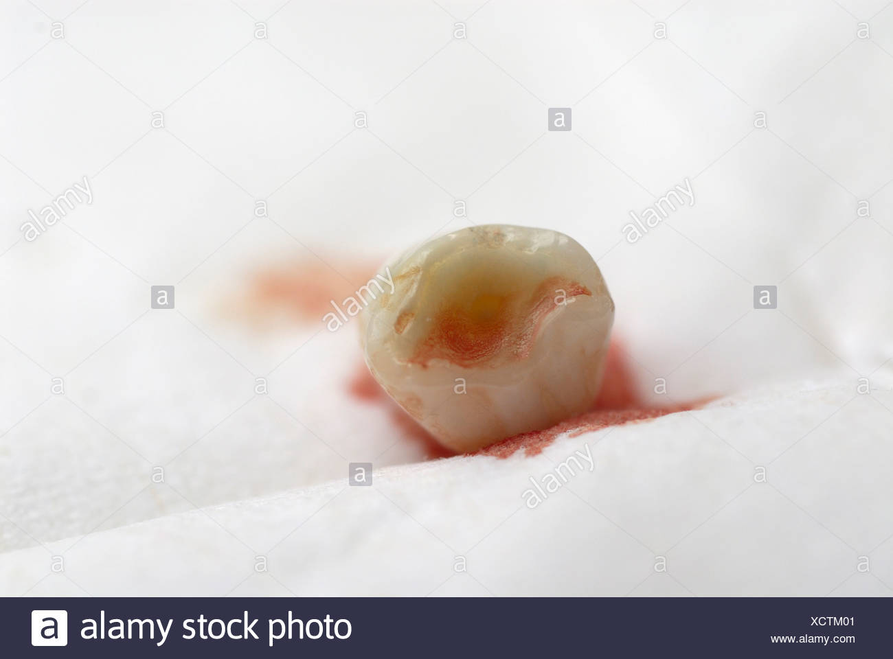 Teeth Blood High Resolution Stock Photography and Images - Alamy