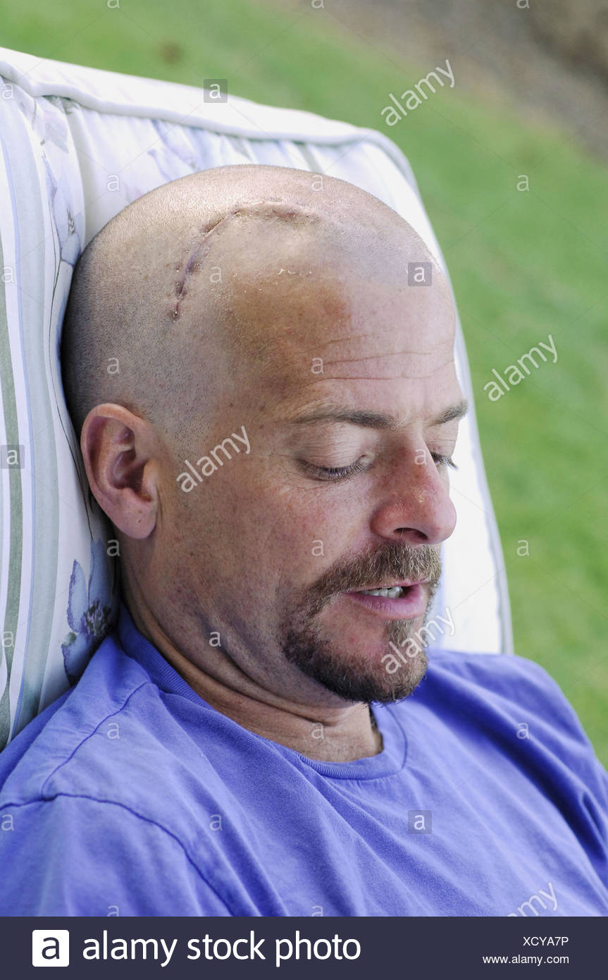 Craniotomy High Resolution Stock Photography and Images - Alamy