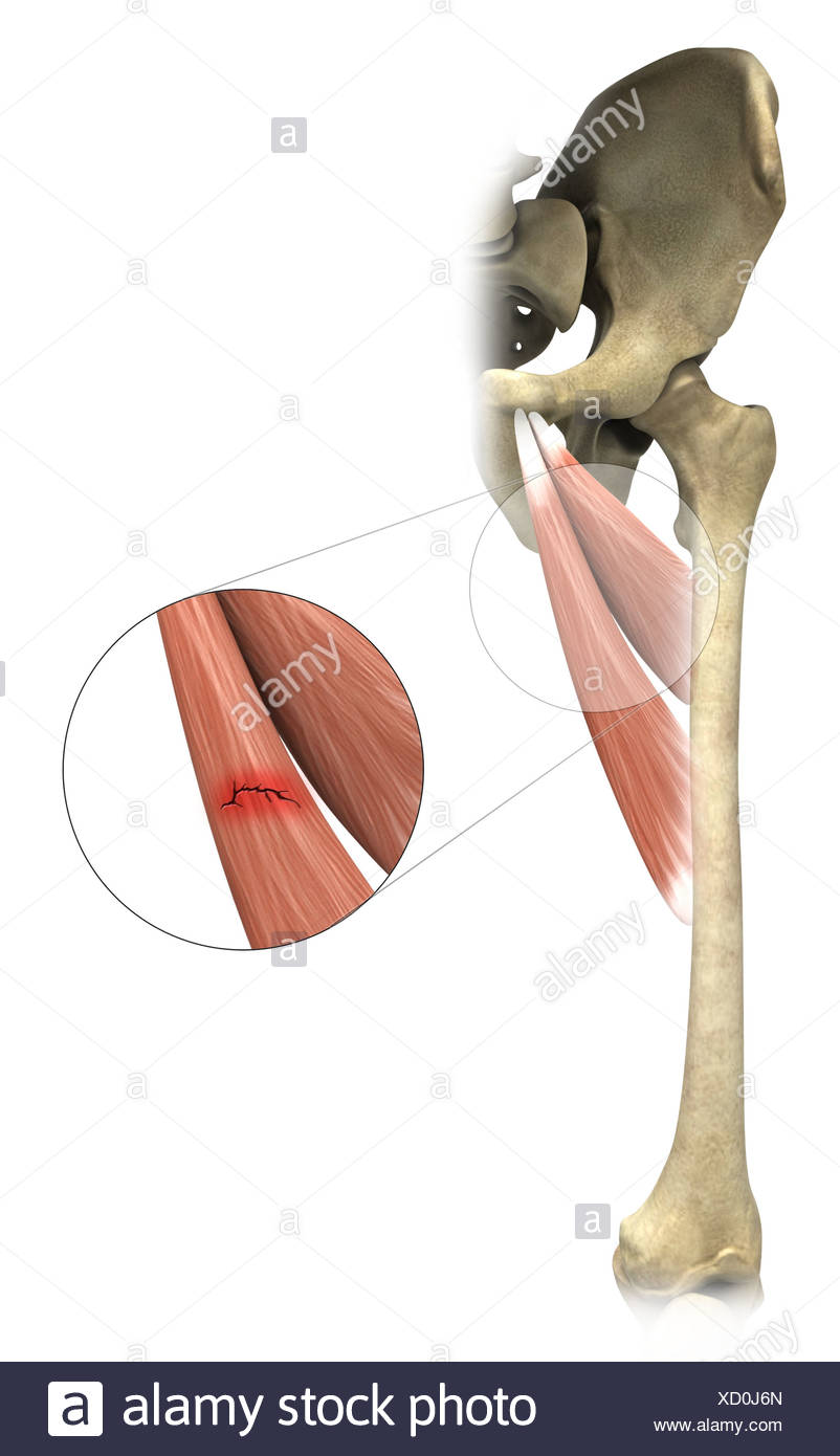 Adductor Muscles Stock Photos & Adductor Muscles Stock Images - Alamy