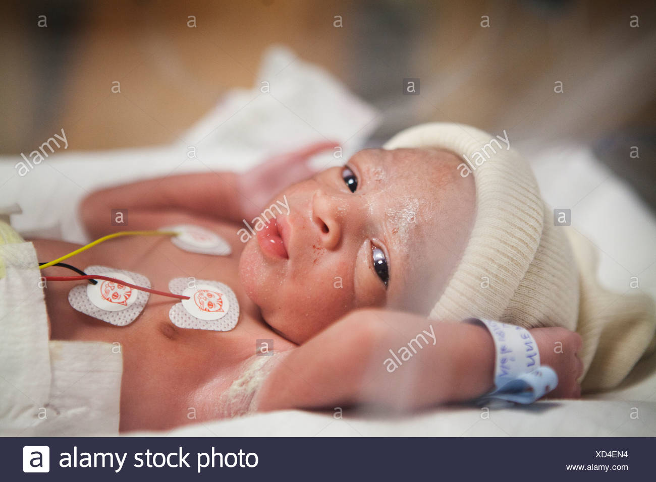 Ecg Boy Electrodes High Resolution Stock Photography and Images - Alamy