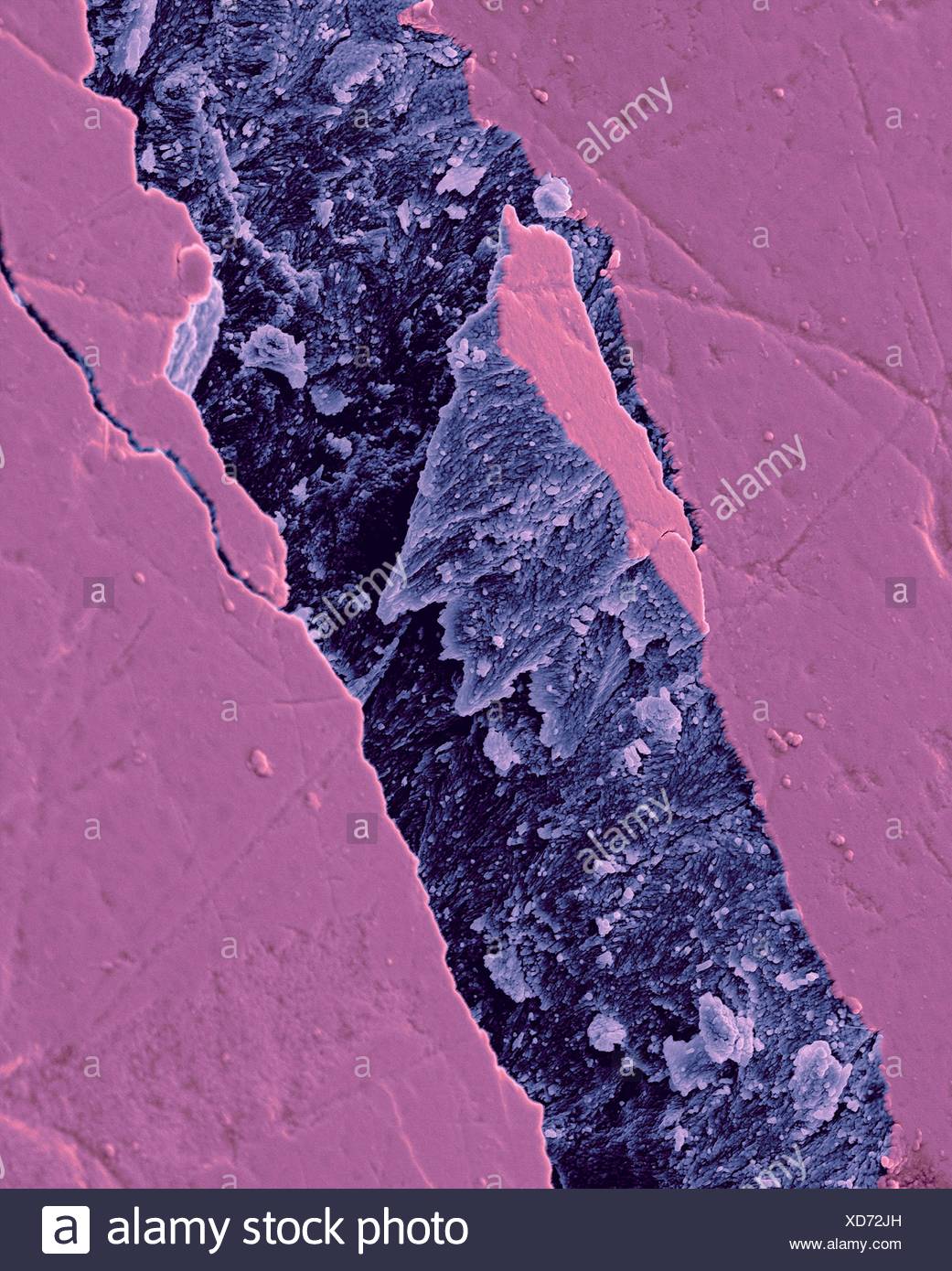 Tooth Morphology High Resolution Stock Photography and Images - Alamy