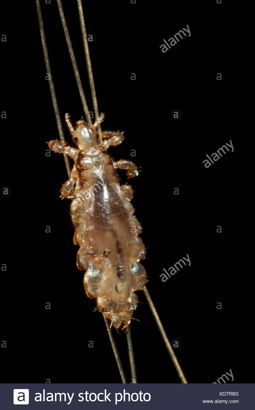 Pediculus Humanus Capitis High Resolution Stock Photography and Images ...