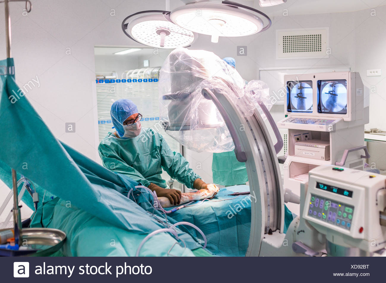 An Open Fracture High Resolution Stock Photography and Images - Alamy