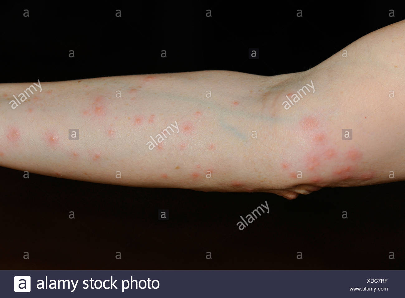 Neotrombicula Stock Photos & Neotrombicula Stock Images - Alamy