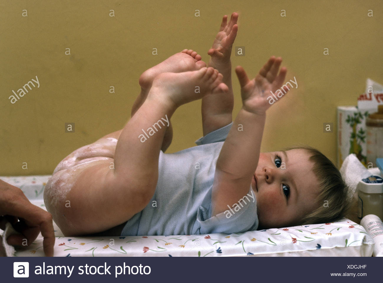 Baby With Rash High Resolution Stock Photography and Images - Alamy