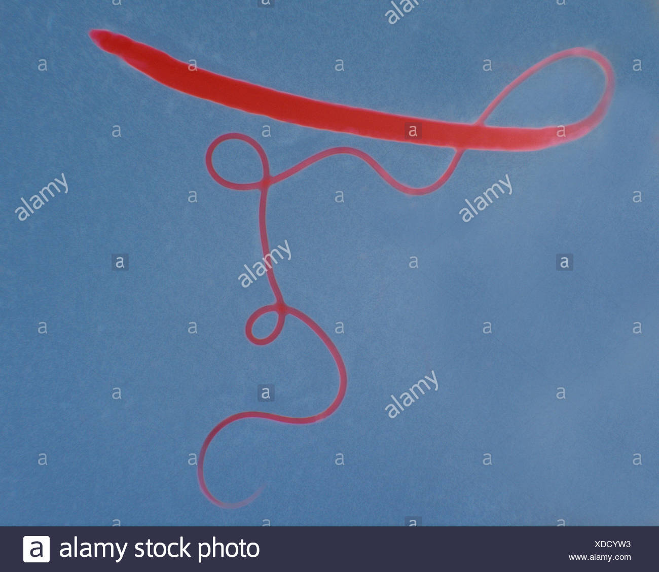 Trichuris Trichiura High Resolution Stock Photography and Images - Alamy
