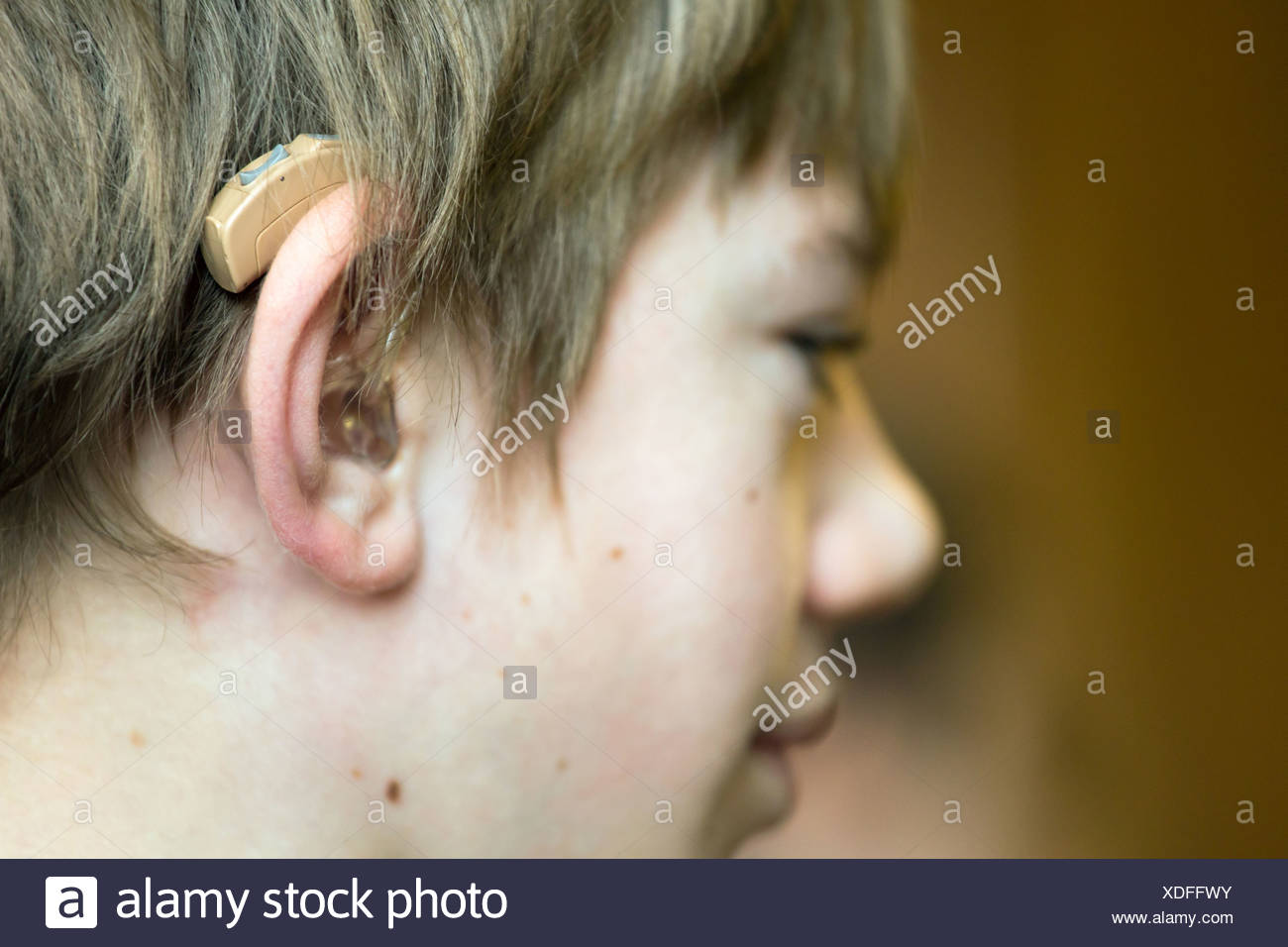 Deaf Child Hearing Aid High Resolution Stock Photography and Images - Alamy