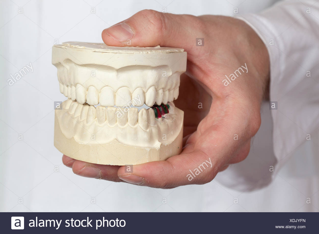 Teeth Moulds High Resolution Stock Photography and Images - Alamy