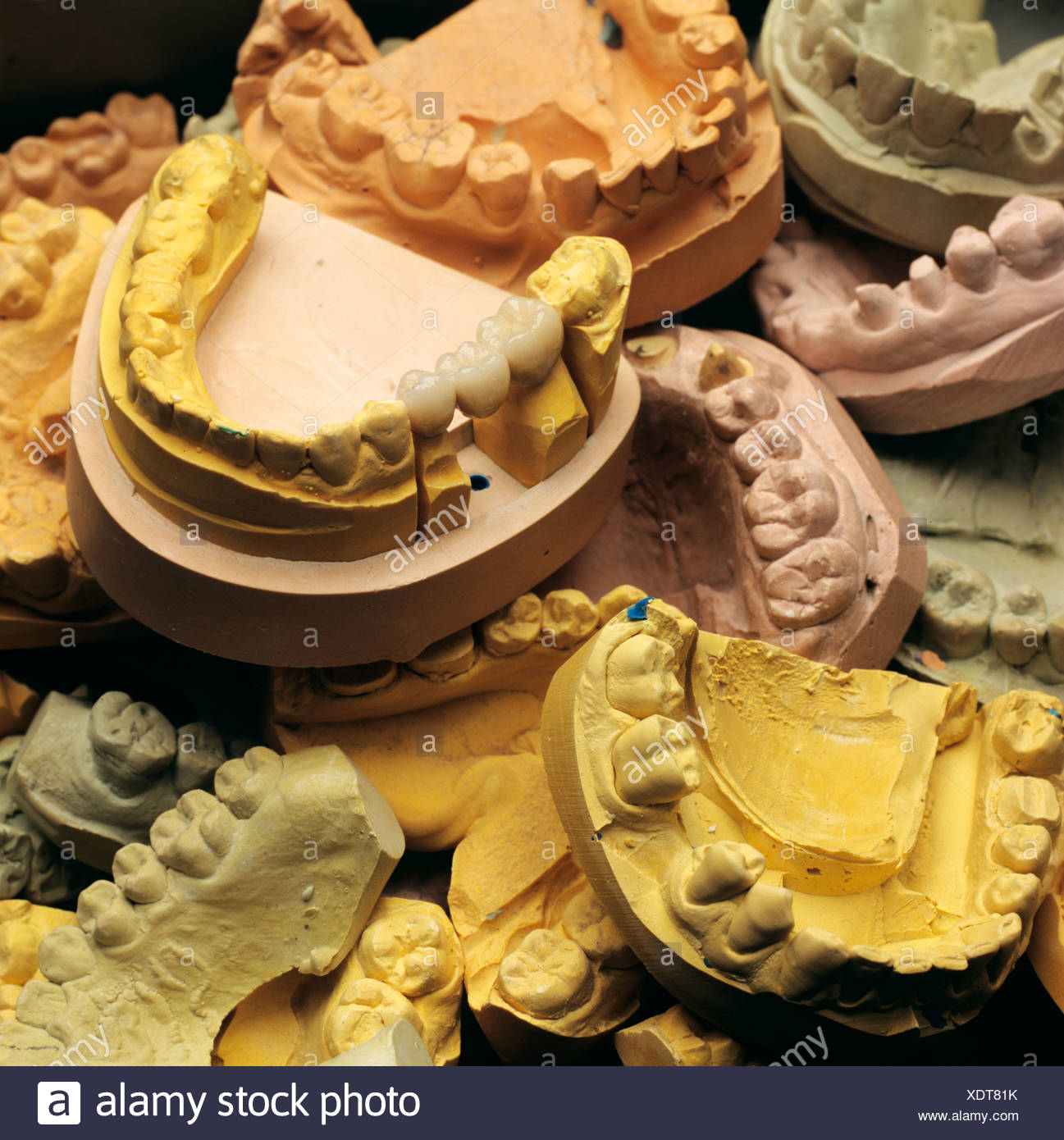 Dental Models High Resolution Stock Photography and Images - Alamy