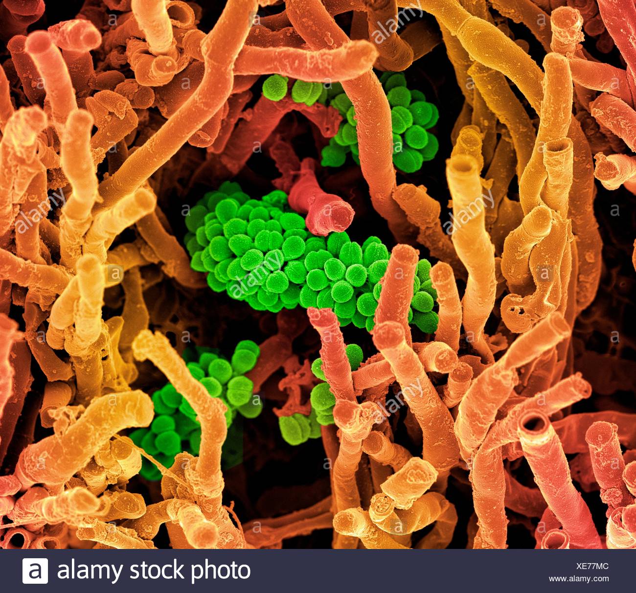 Streptomyces High Resolution Stock Photography and Images - Alamy